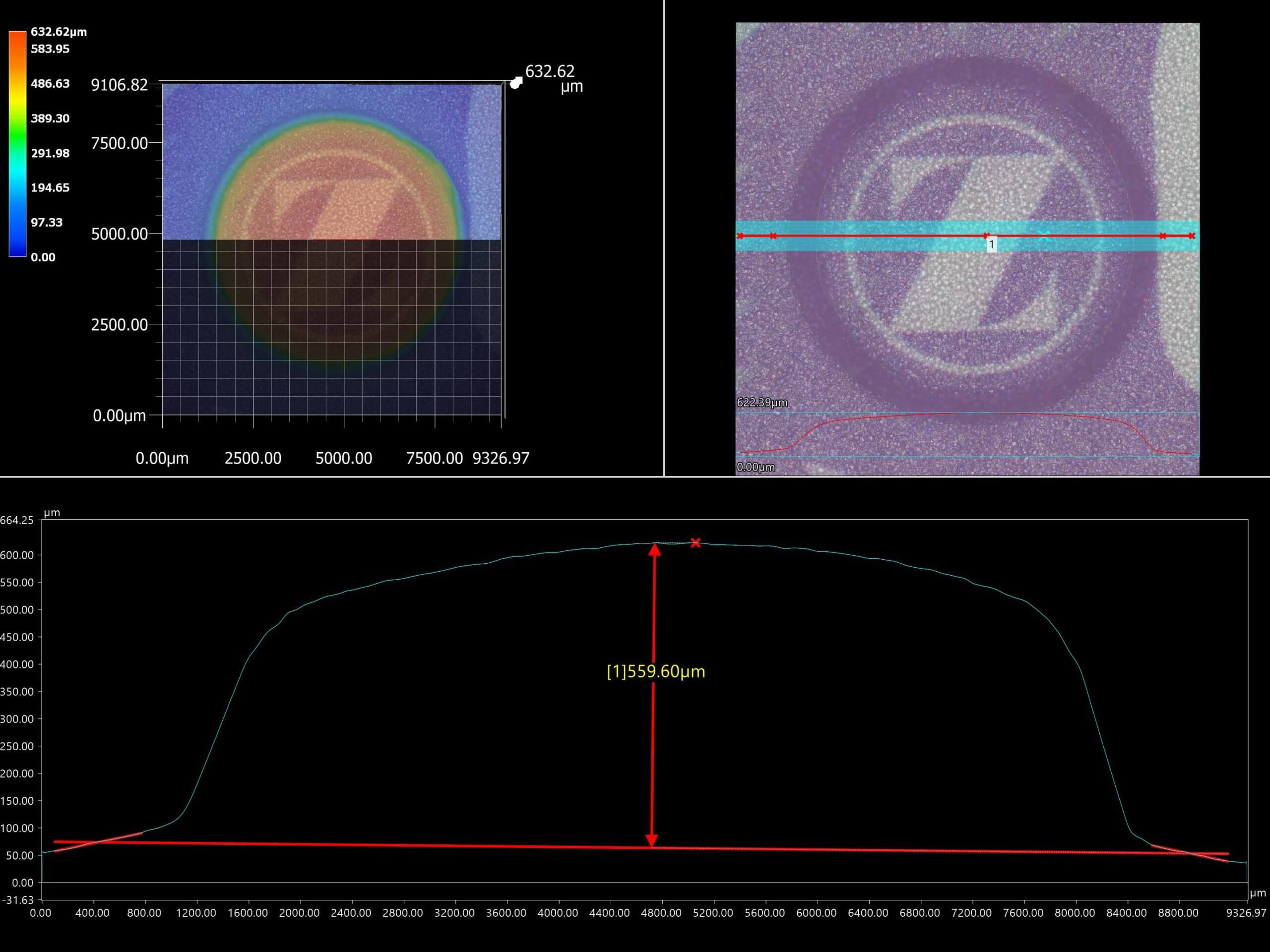 Our latest custom-made graphic overlay for the medical industry | Memtronik